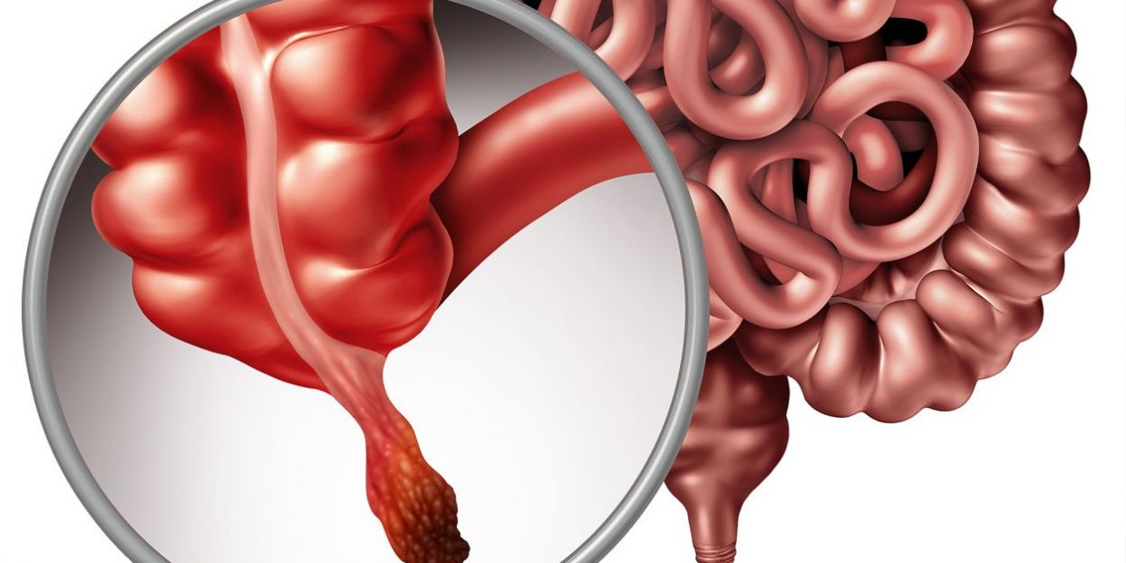 ¿Por qué tenemos apéndice si se dice que no sirve para nada?