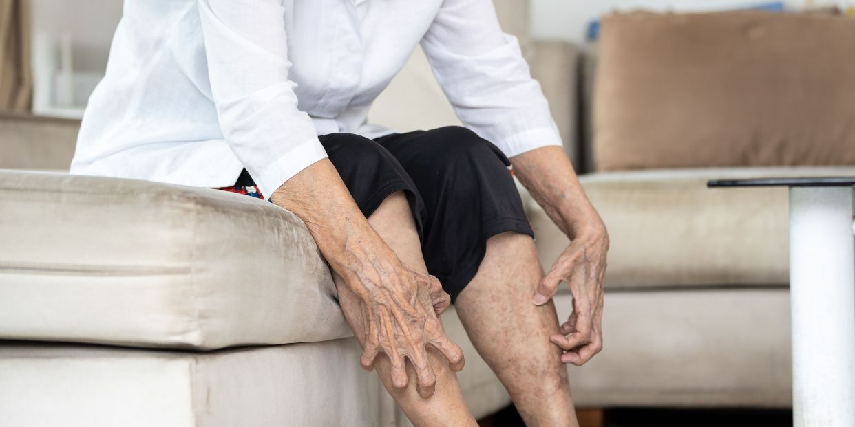 ¿Por qué las personas mayores tienen más lesiones cutáneas?