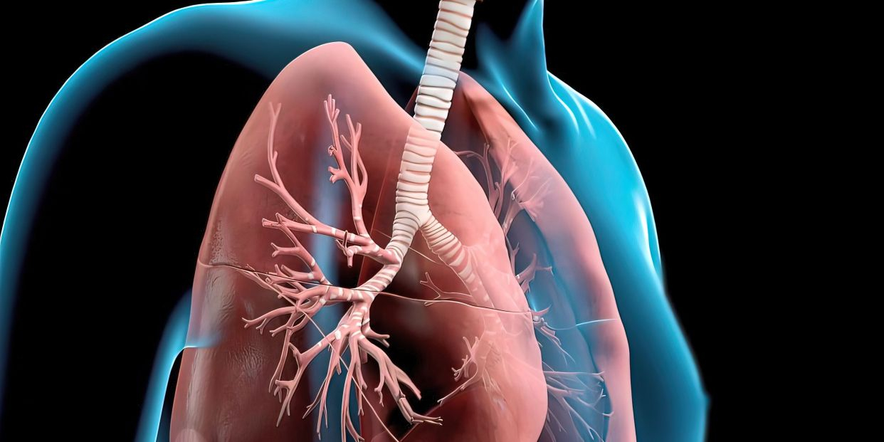 Qué diferencia hay entre bronquitis y bronquiolitis