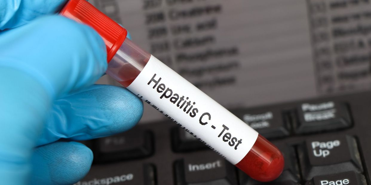 Prueba más rápida y barata para detectar la hepatitis C