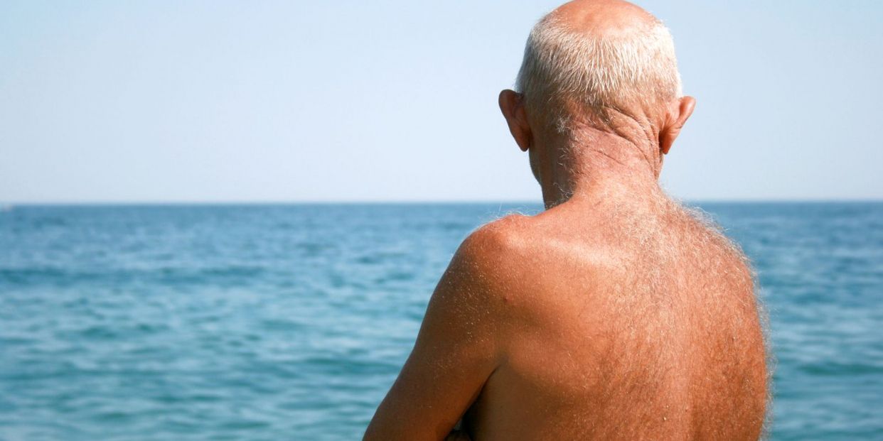 Cómo evitar que la piel se pele después de tomar el sol