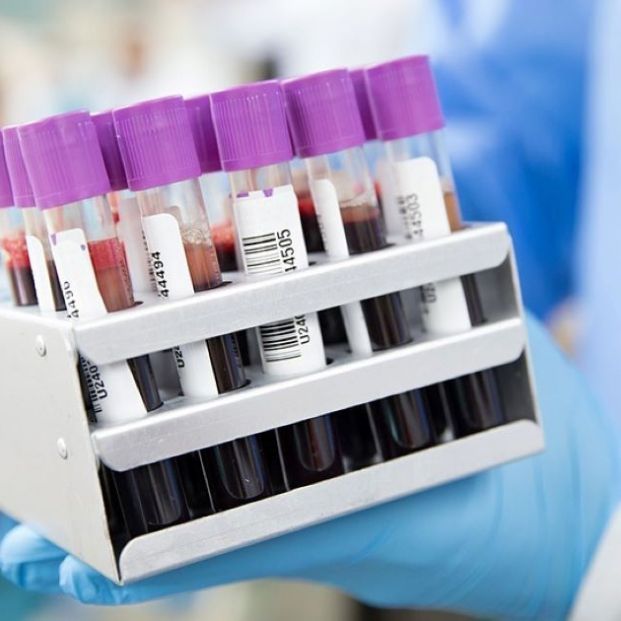 Un test rápido para detectar cáncer de páncreas