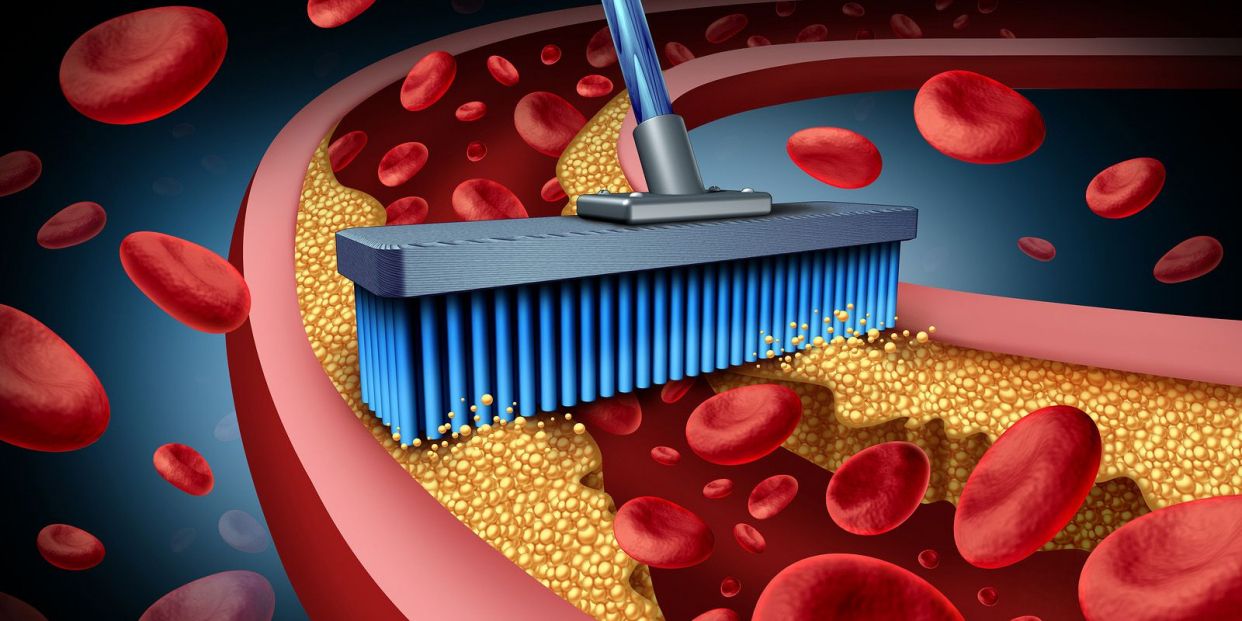 Quiero saber qué es la terapia de quelación