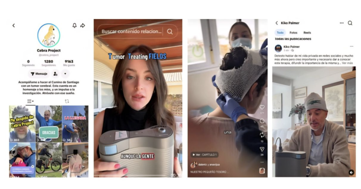 Las redes sociales sacan del silencio al glioblastoma