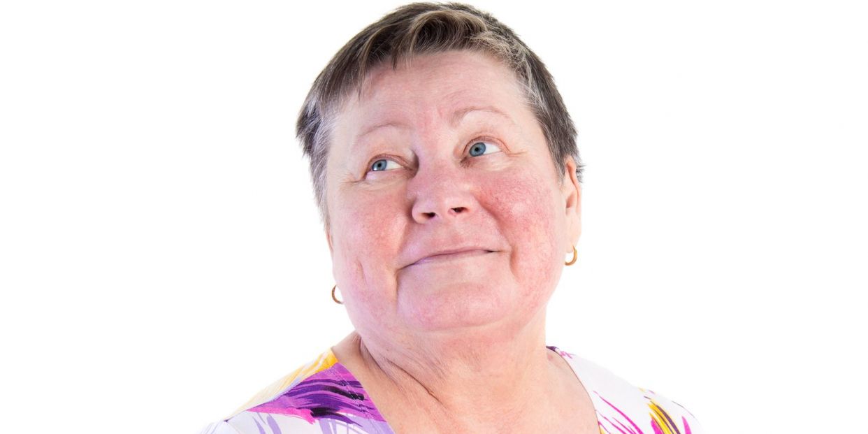 Mejillas rojas por la cuperosis o la rosácea