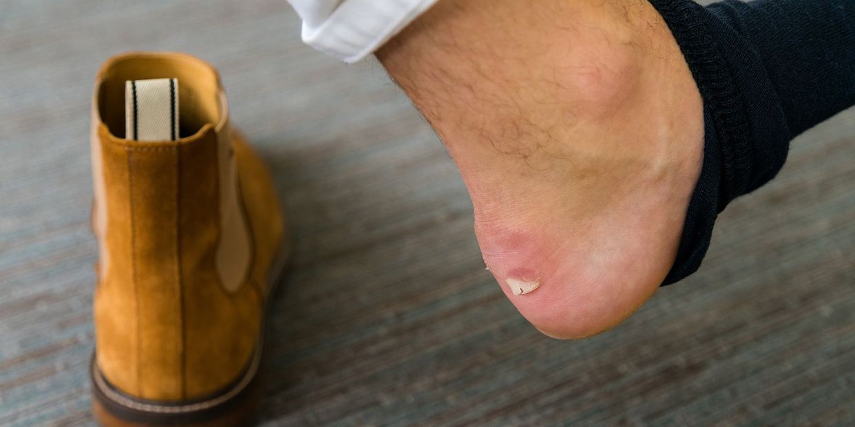 ¿Rozaduras? Te damos unos trucos para evitarlas