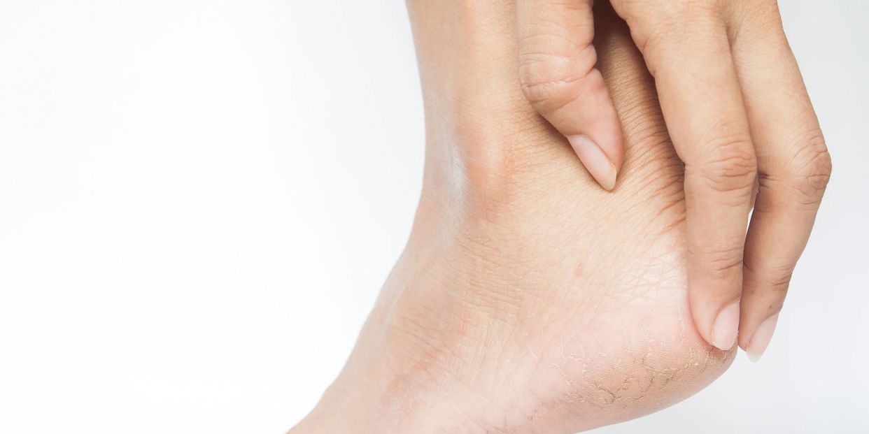 Cómo evitar las rozaduras de los zapatos nuevos