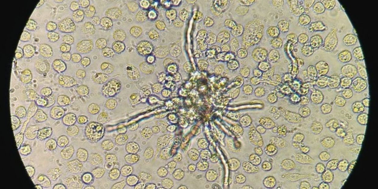 ¿Qué es el 'hongo negro'?